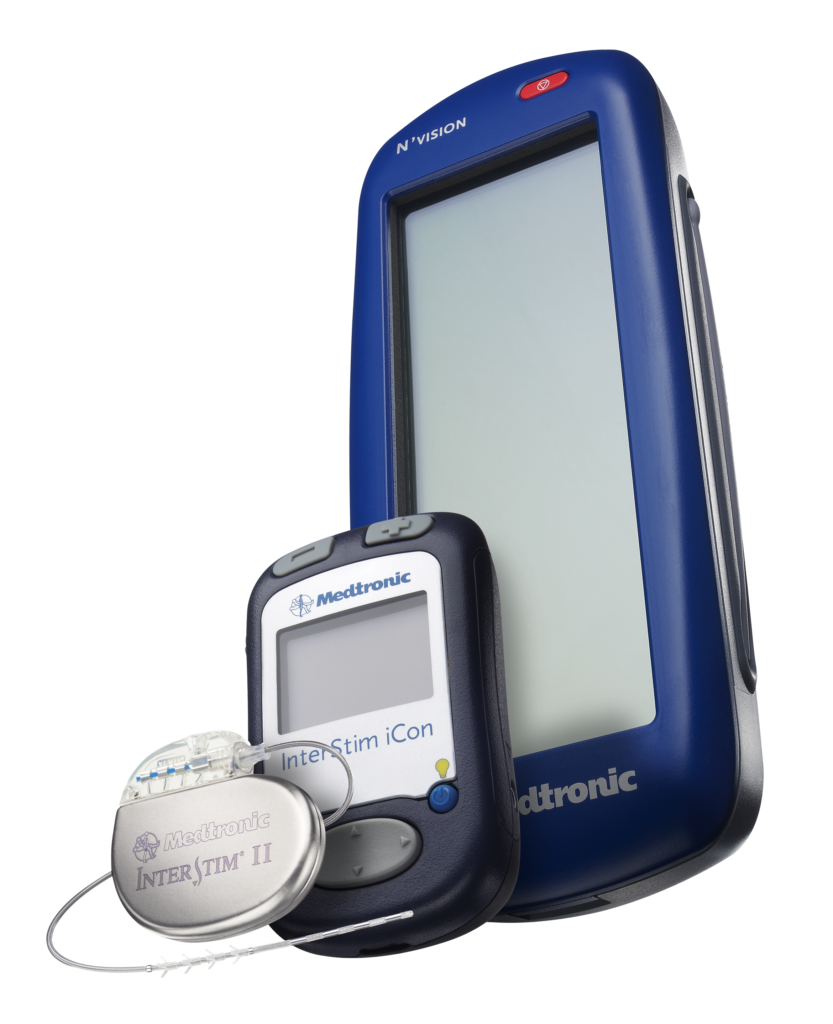 Interstim Procedure: What is Involved in Stage 1 and Stage 2 - Urinary ...