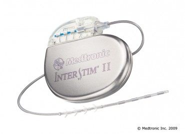 Interstim Battery Replacement, Revision and Removal – Urinary and ...
